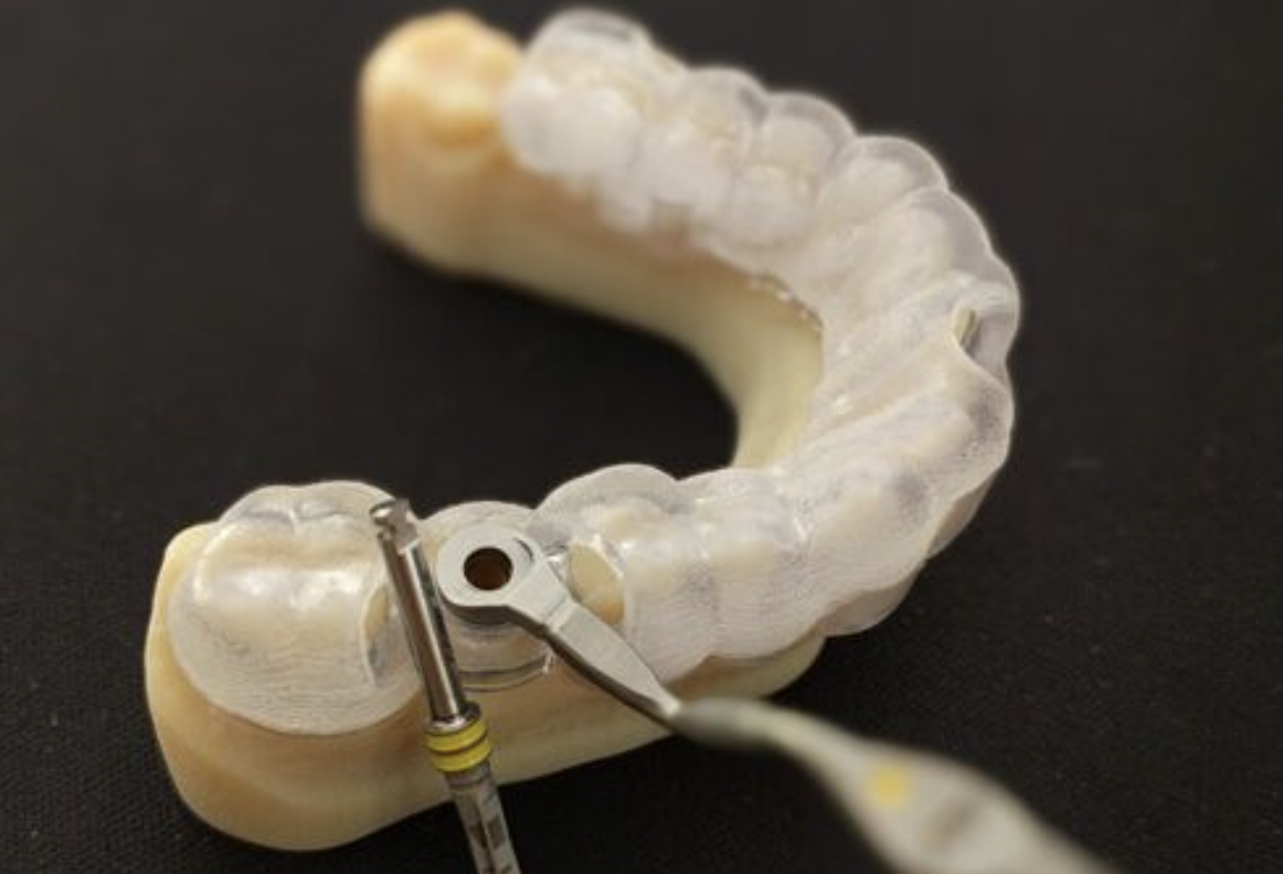 Surgical Guides - revealguides.com