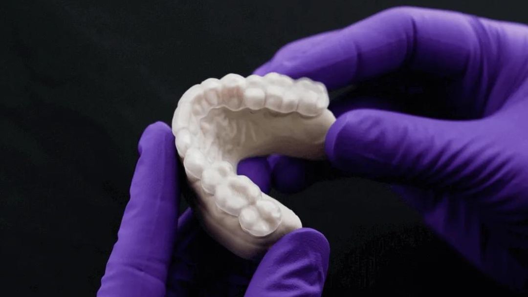 3D Printed Mouthguards, Nightguards & Splints with Keysplint Soft ...