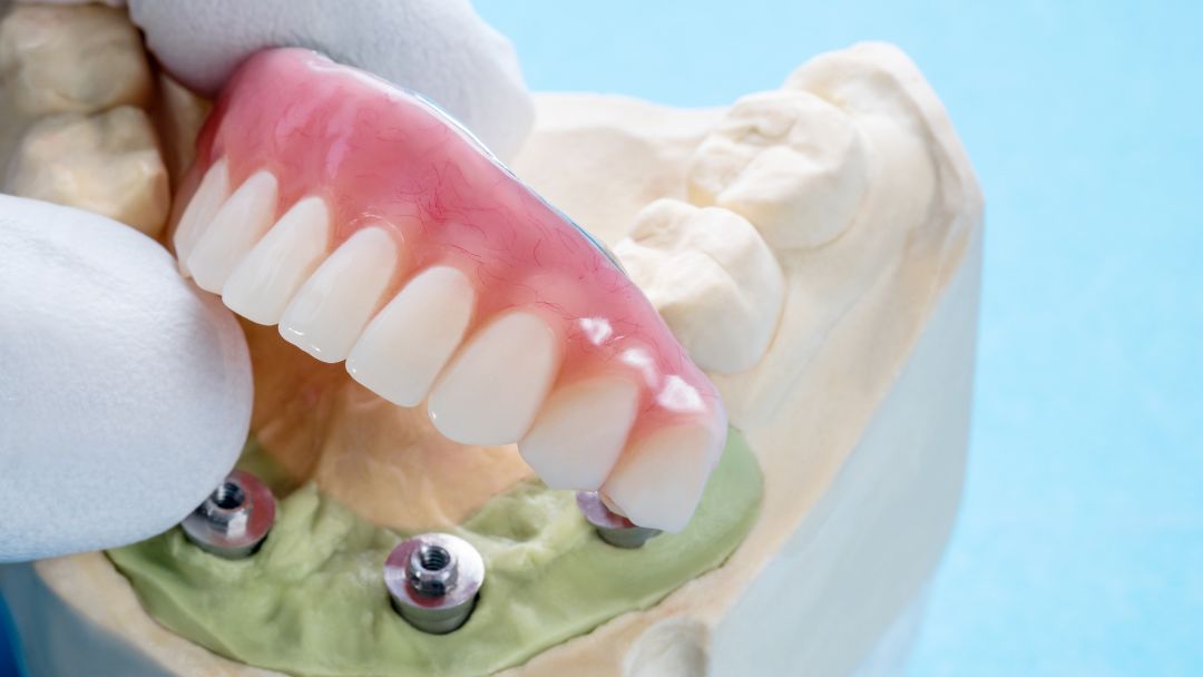Looking To Start CT Guided Surgery? - revealguides.com